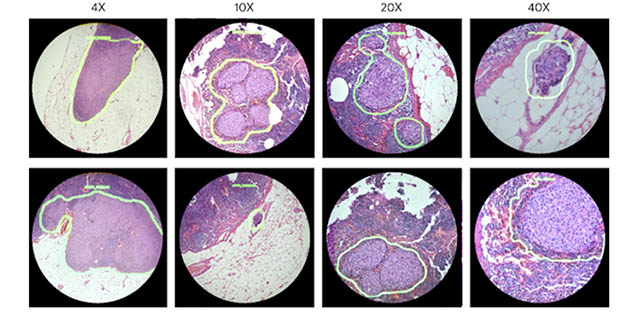 Google Has Made an AR Microscope that Can Detect Cancer Cells in Real ...